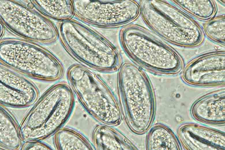 Ossiuri: come si curano i vermi dei bambini - Ambiente Bio